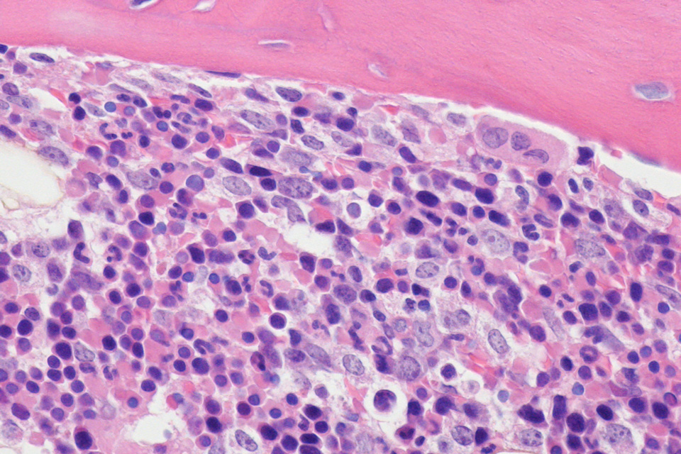 Bone Marrow Workshop - College of Veterinary Medicine - Purdue University